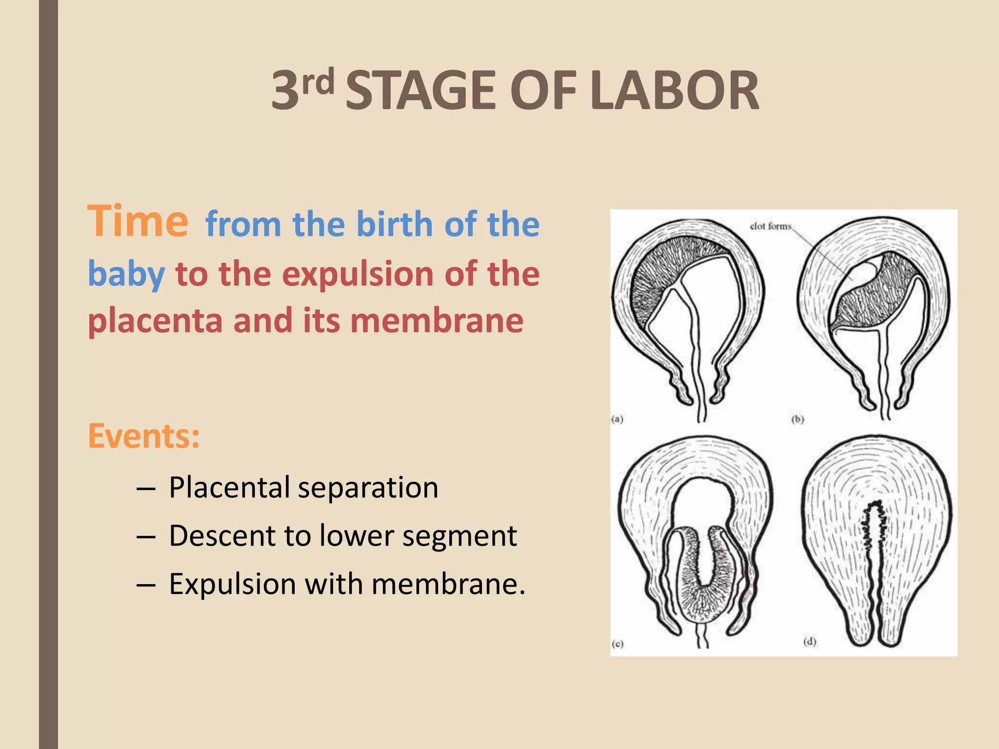 Complications of 3 rd stage of the Labour | PPTX