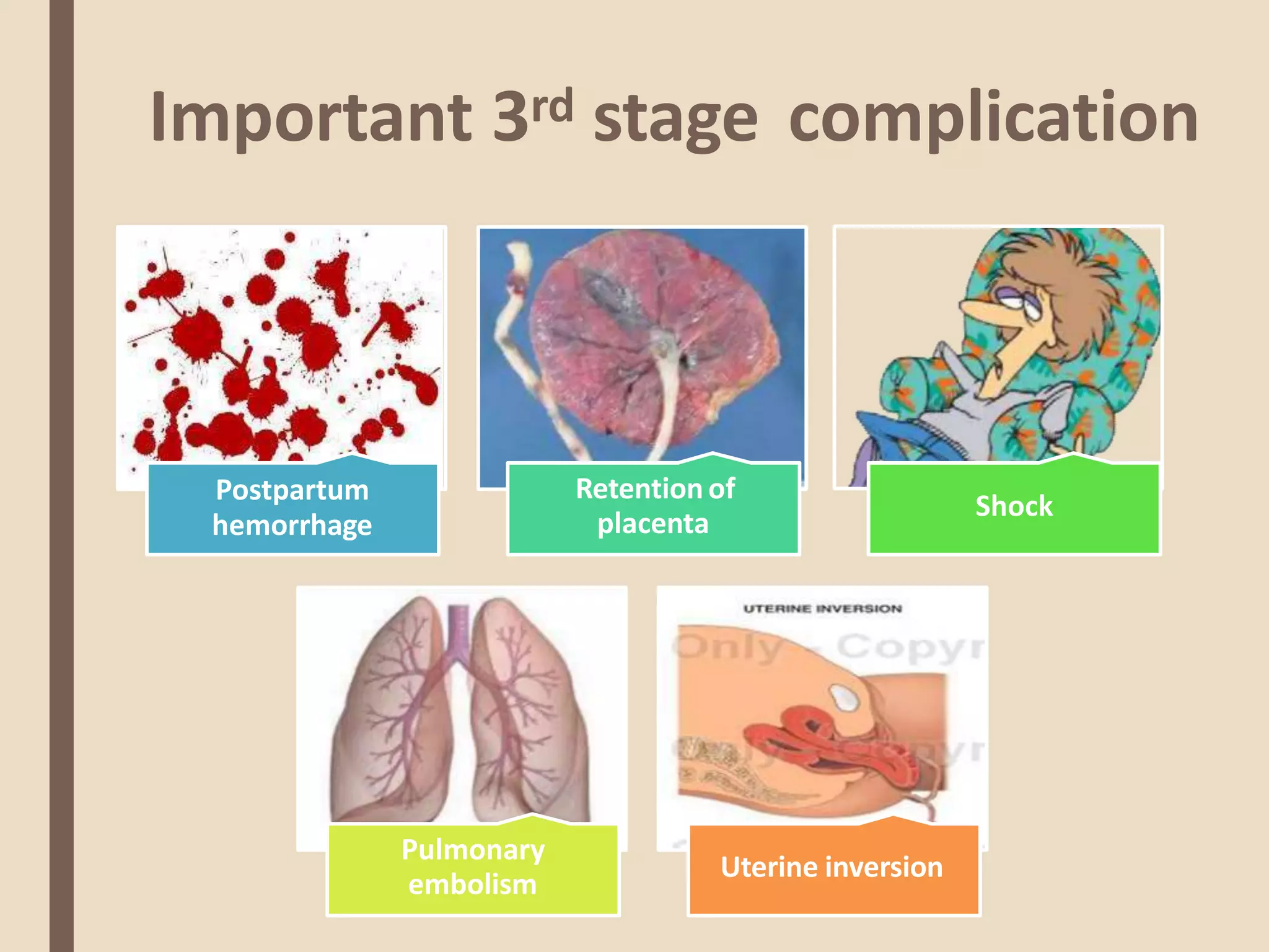 Complications of 3 rd stage of the Labour | PPTX