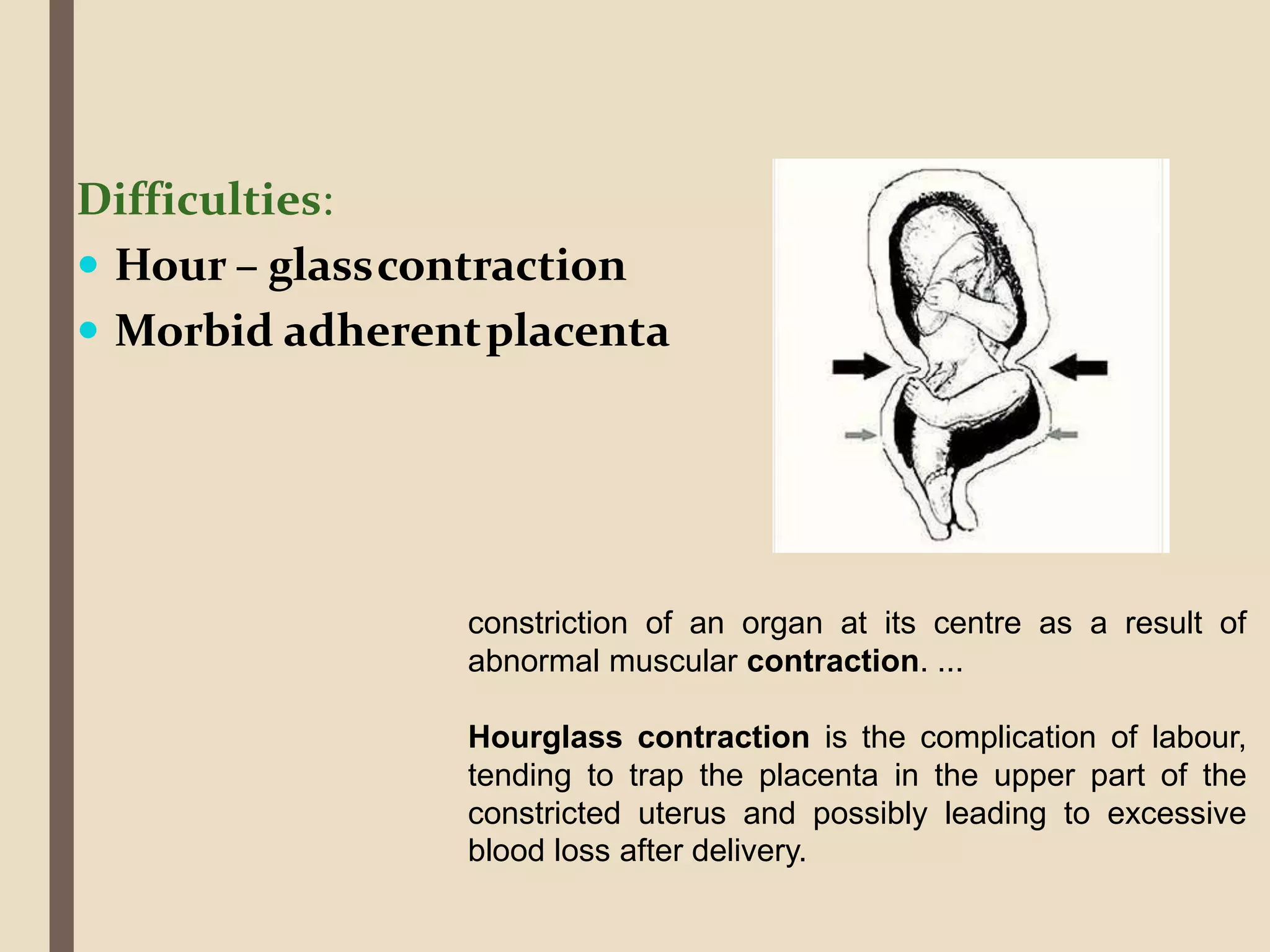 Complications of 3 rd stage of the Labour | PPTX