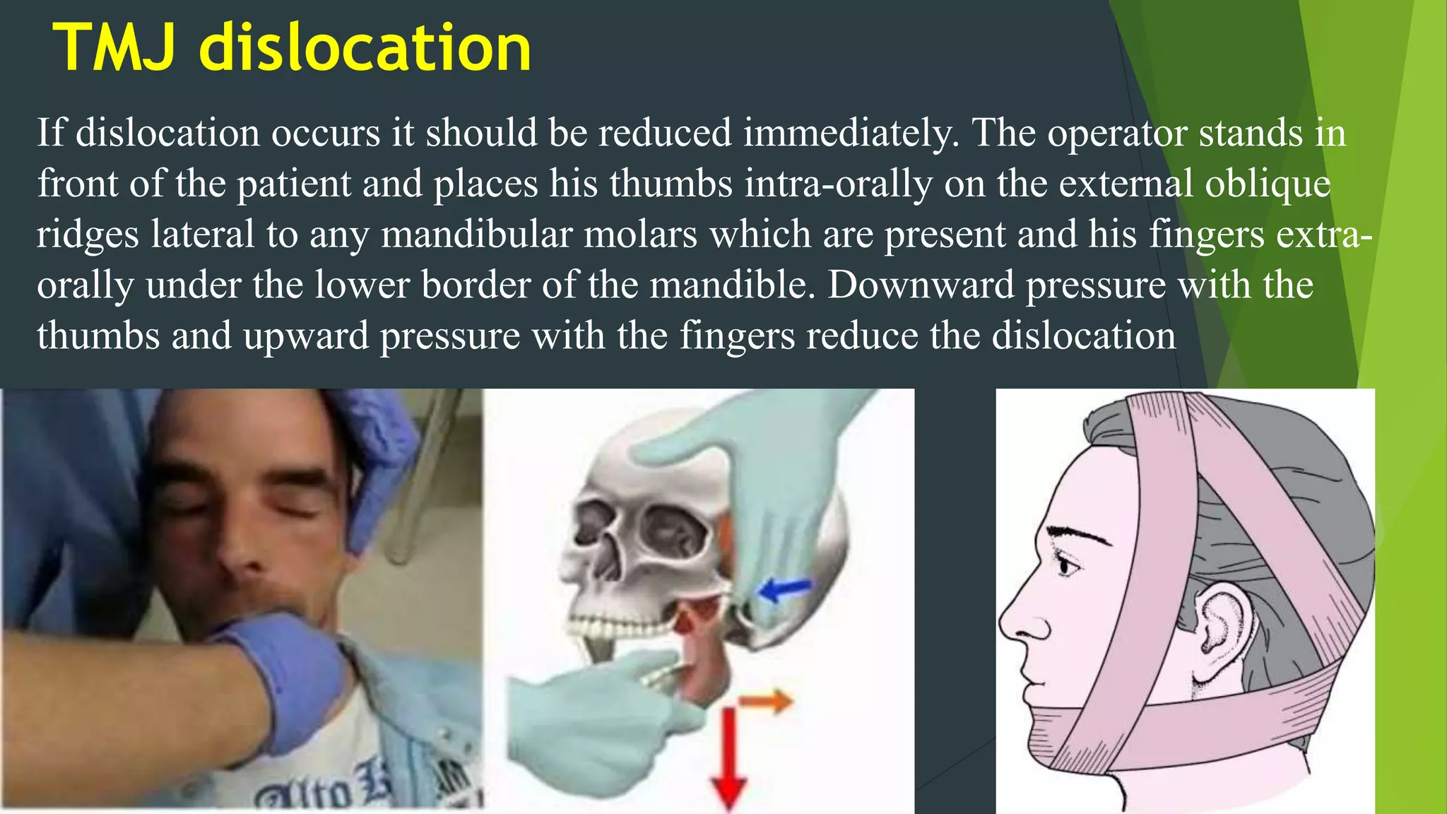 Complications of tooth extraction | PPTX