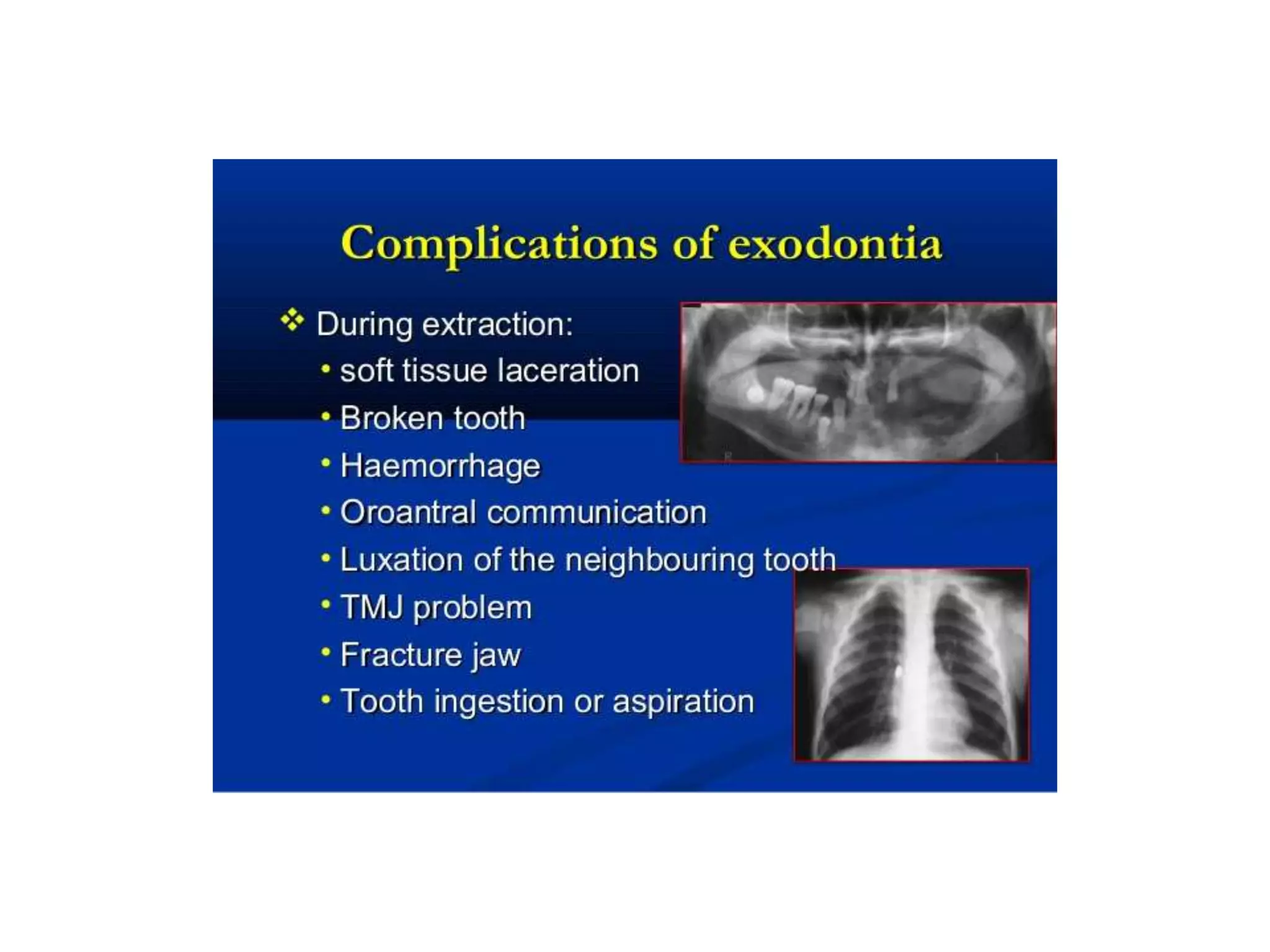 Complications of tooth Extraction.pptx | Dental Health | Diseases and ...