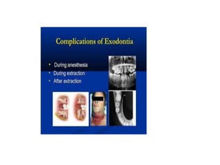 Complications of tooth Extraction.pptx | Dental Health | Diseases and ...