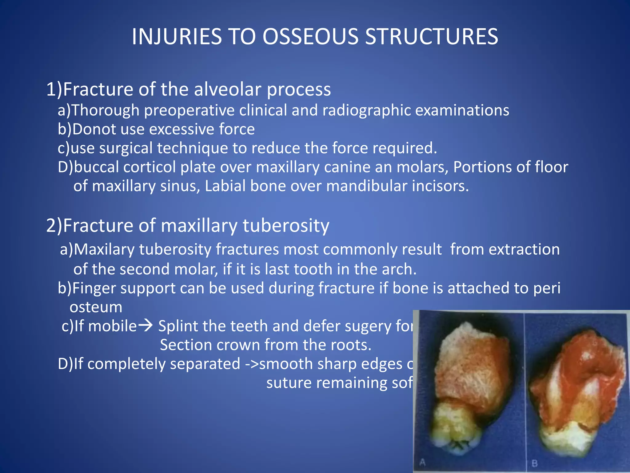 Complications of tooth extraction and its management (oral surgery) | PPTX