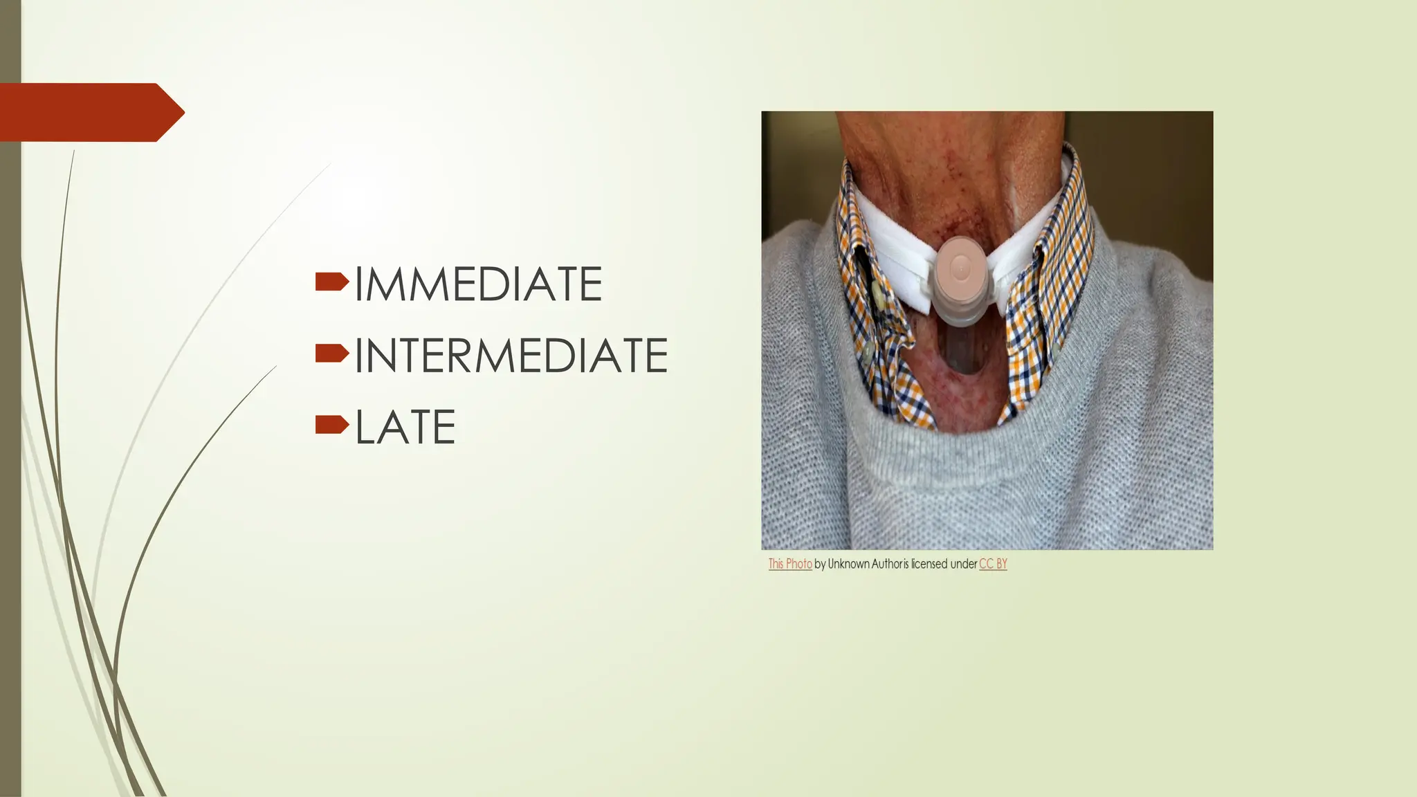 COMPLICATIONS OF TRACHEOSTOMY ent medicinepptx | PPTX