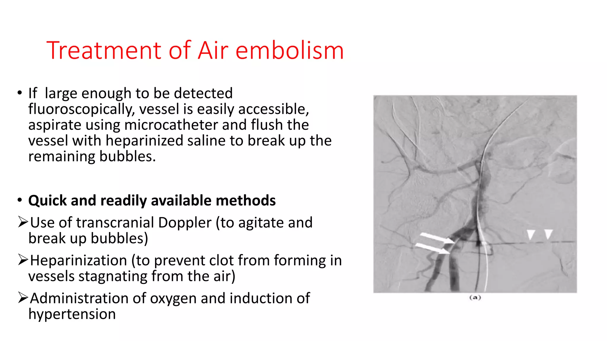 Complications of various neurointerventional procedures and their ...