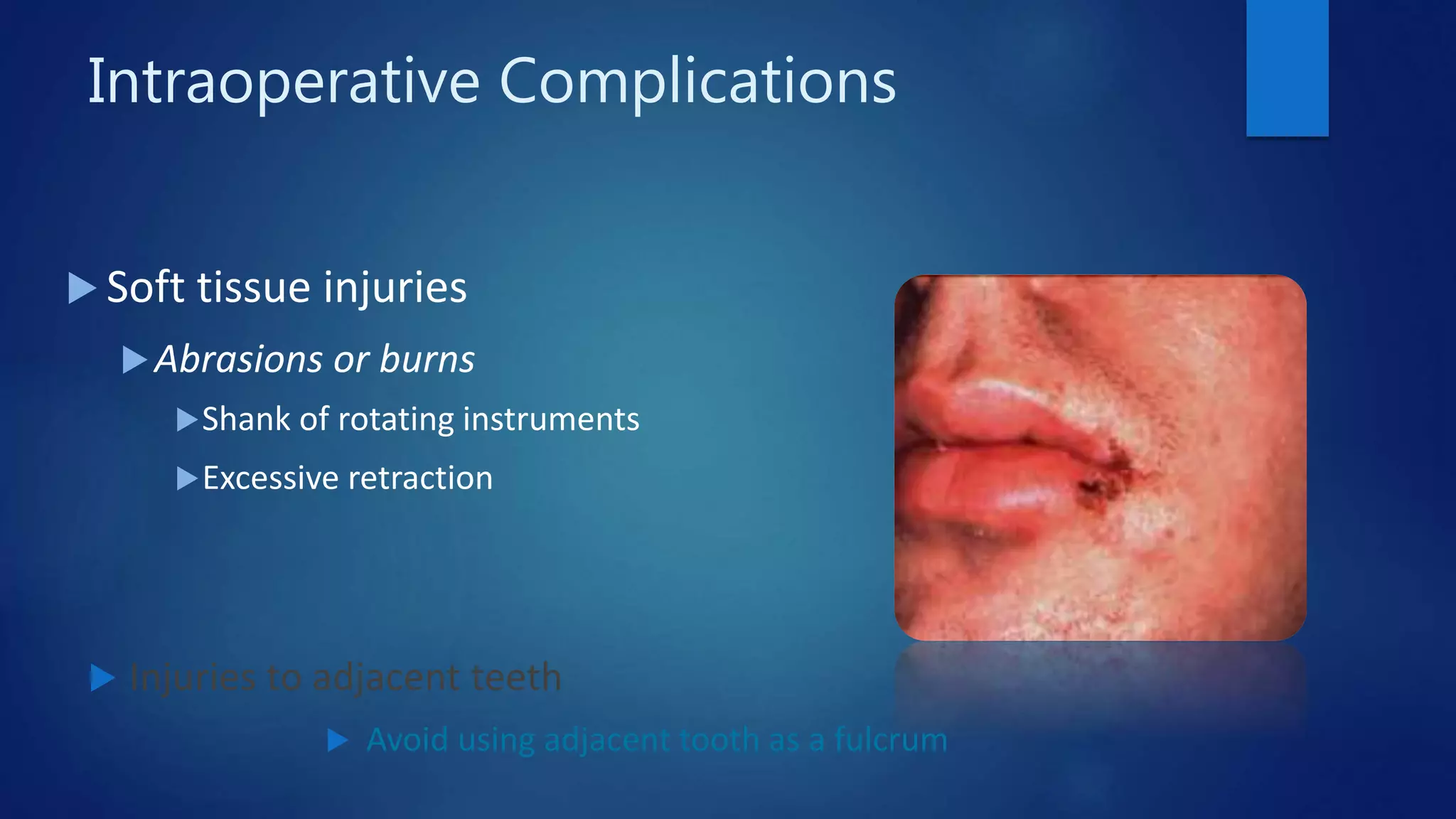 Complications of oral surgery | PPTX