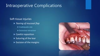 Complications of oral surgery | PPTX
