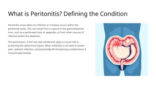 complications peritonitis (патра субхадип).pptx