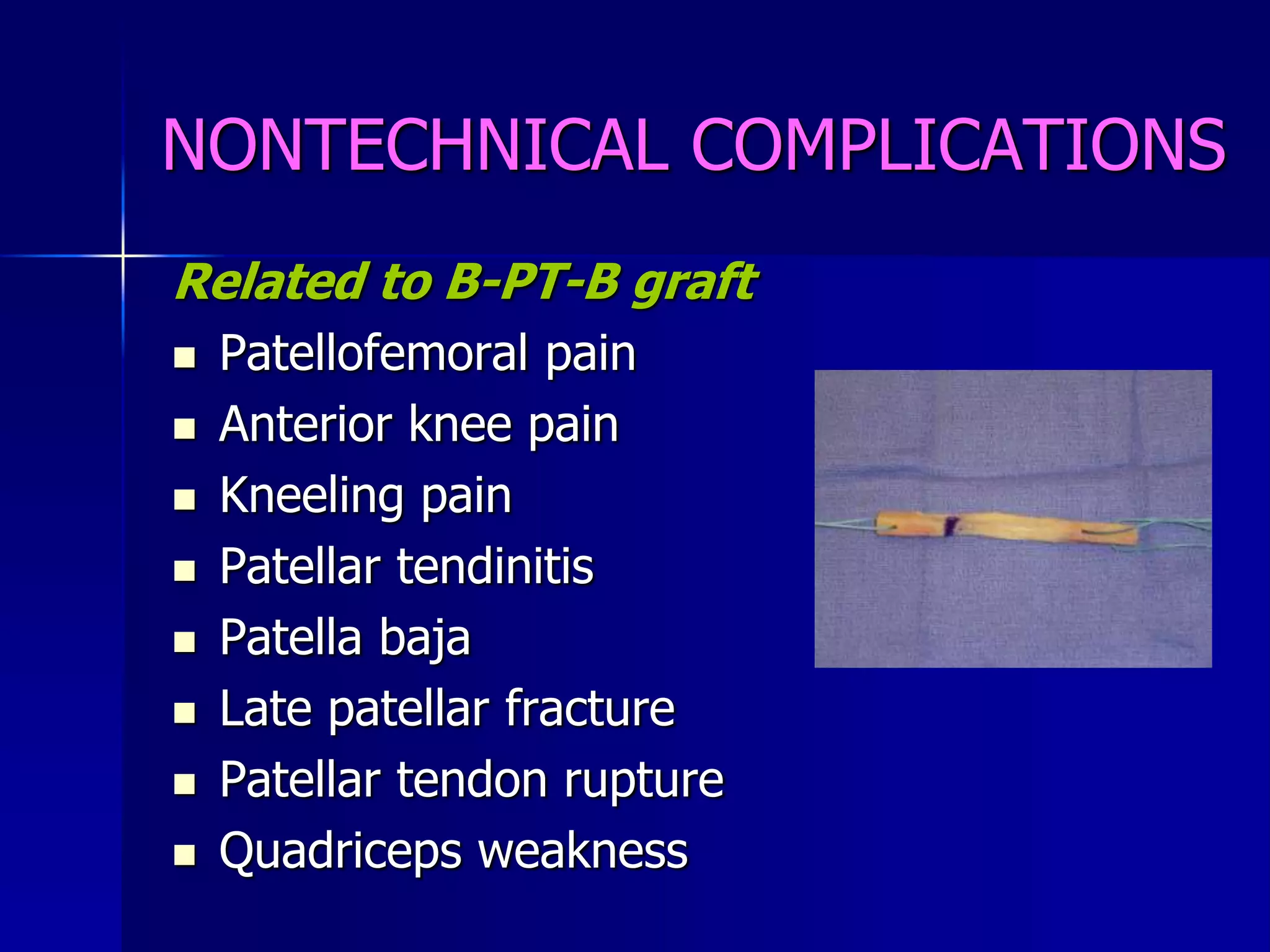 Complications in ACL reconstruction 2014 | PPTX