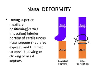 Complications of maxillary orthognathic surgery | PPTX | First Aid ...