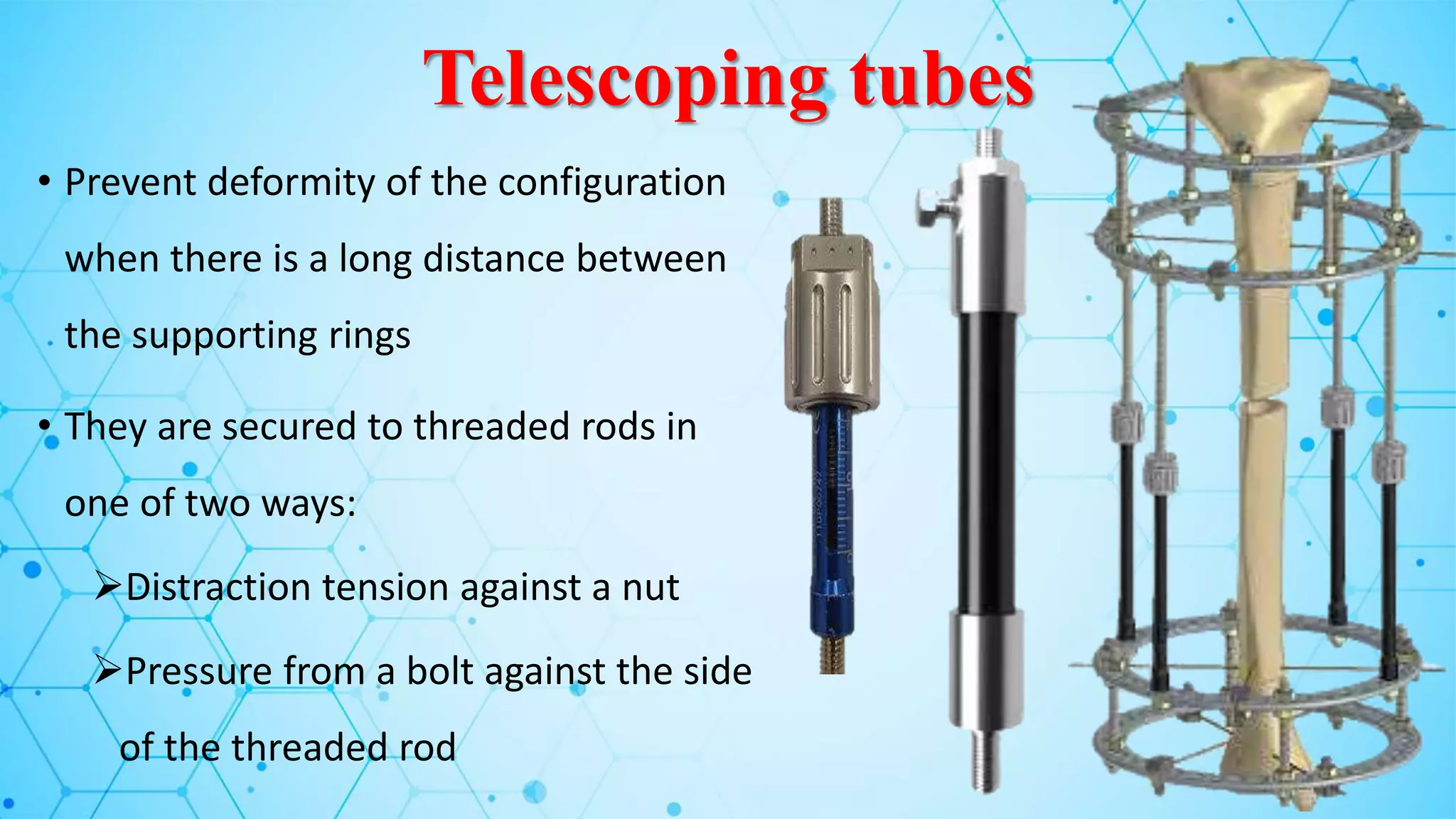 Components of Ilizarov ring ring fixator | PPTX