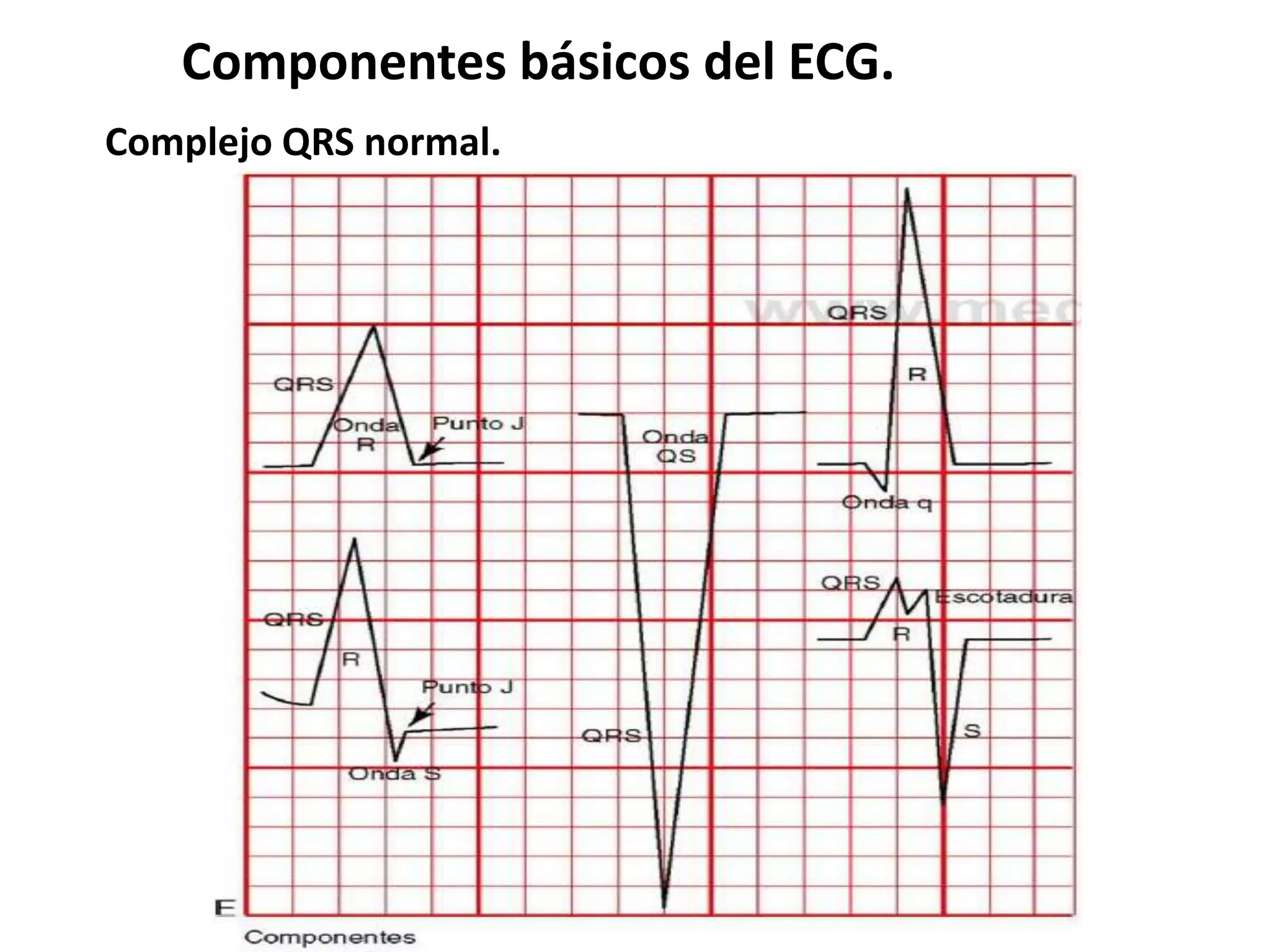 Componentes básicos del electrocardiograma | PPTX