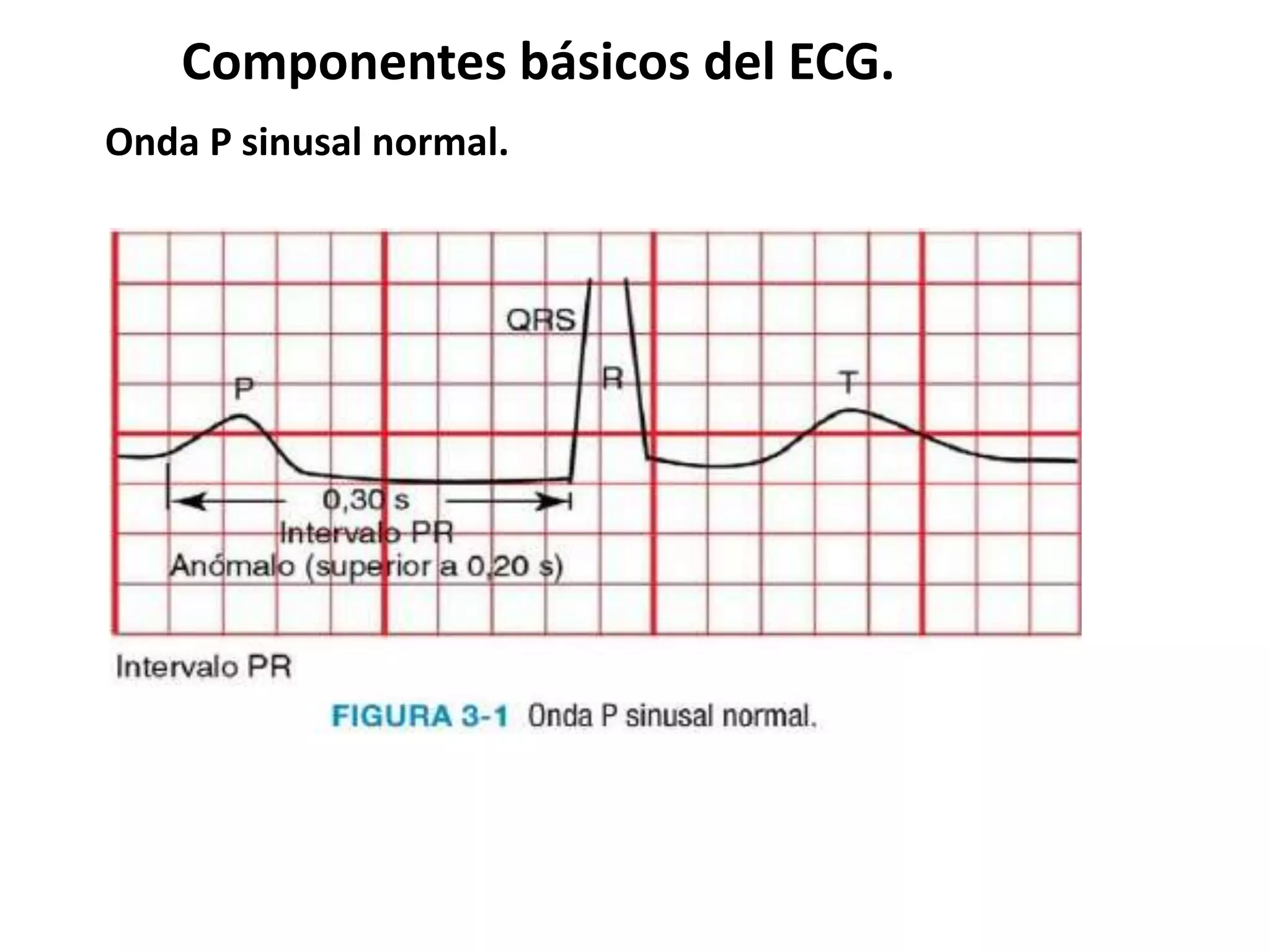 Componentes básicos del electrocardiograma | PPTX