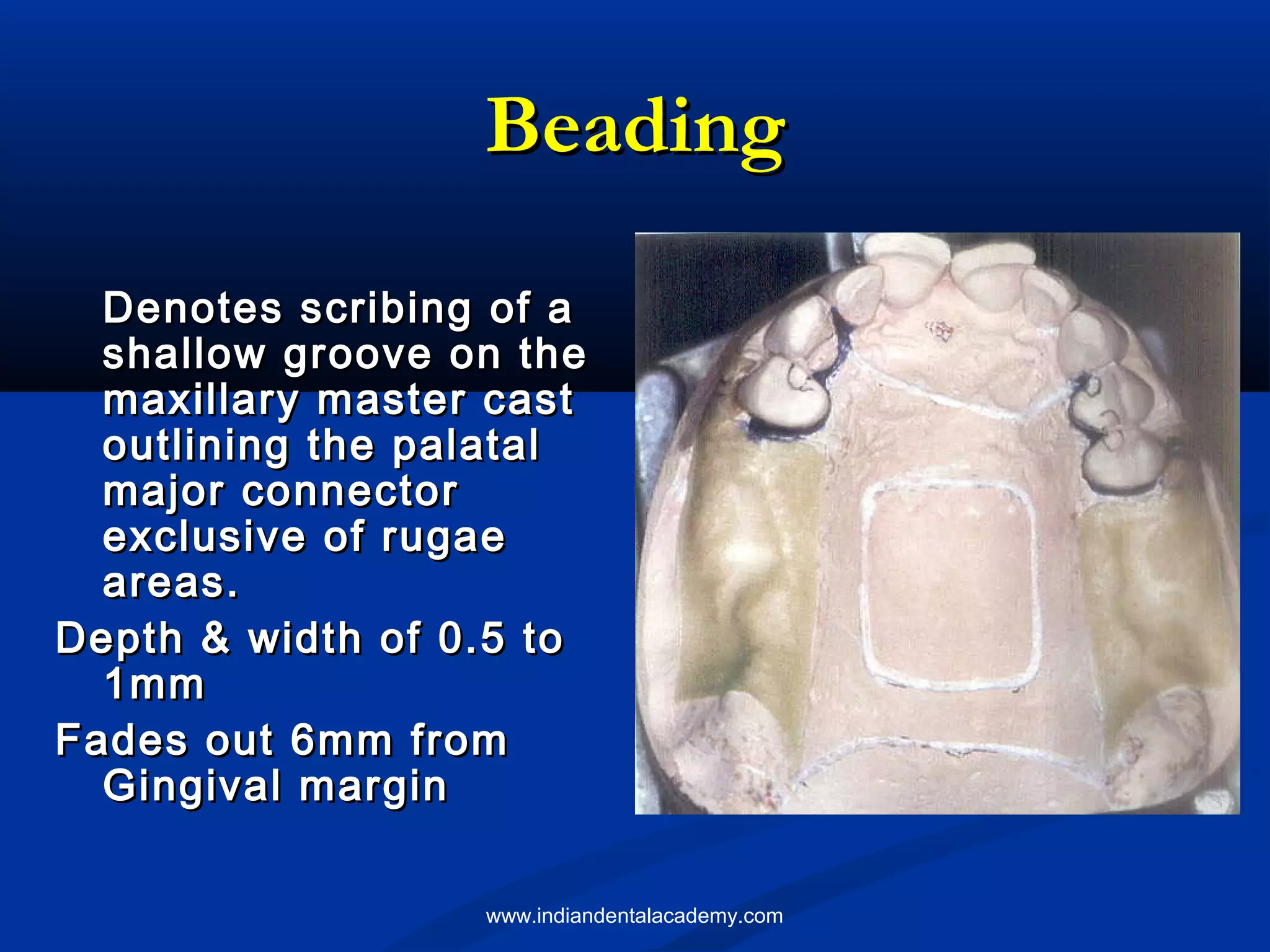 Component parts of cast partial dentures / orthodontic courses | PPT