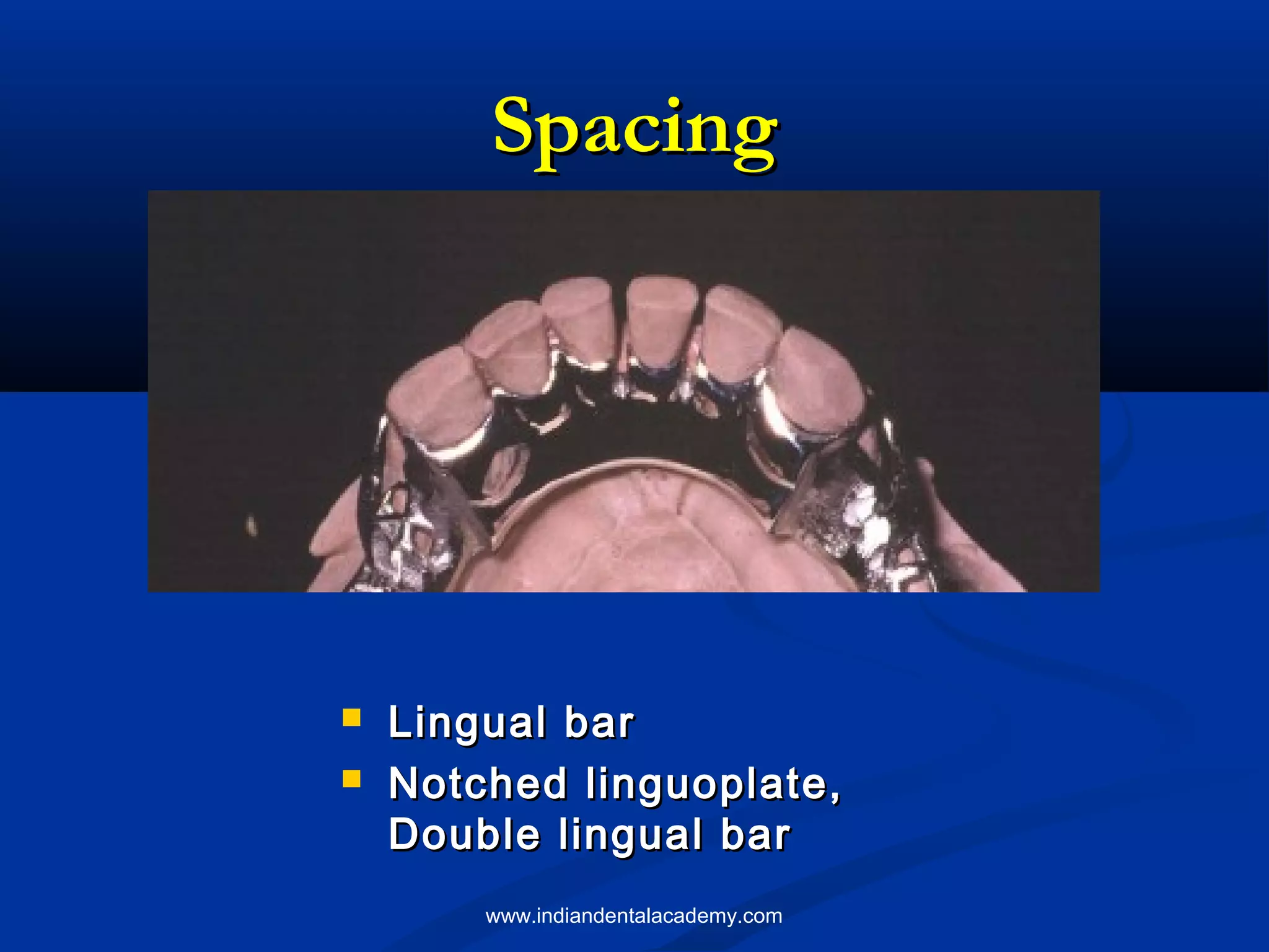 Component parts of cast partial dentures / orthodontic courses | PPT