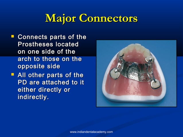 Component parts of cast partial dentures / orthodontic courses | PPT