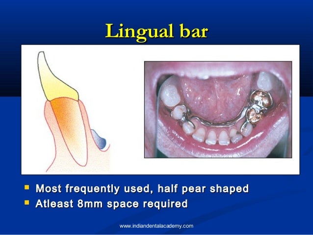 Component parts of cast partial dentures / orthodontic courses