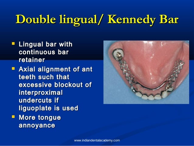 Component parts of cast partial dentures / orthodontic courses