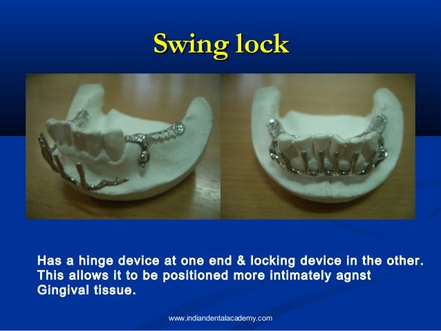 Component parts of cast partial dentures / orthodontic courses
