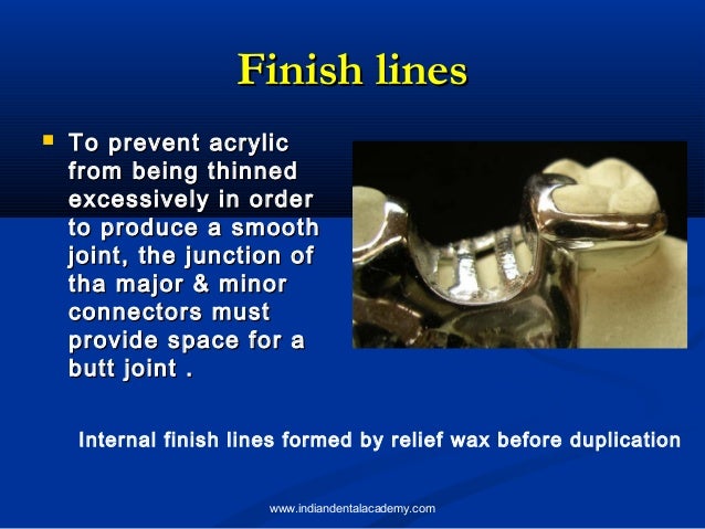 Component parts of cast partial dentures / orthodontic courses