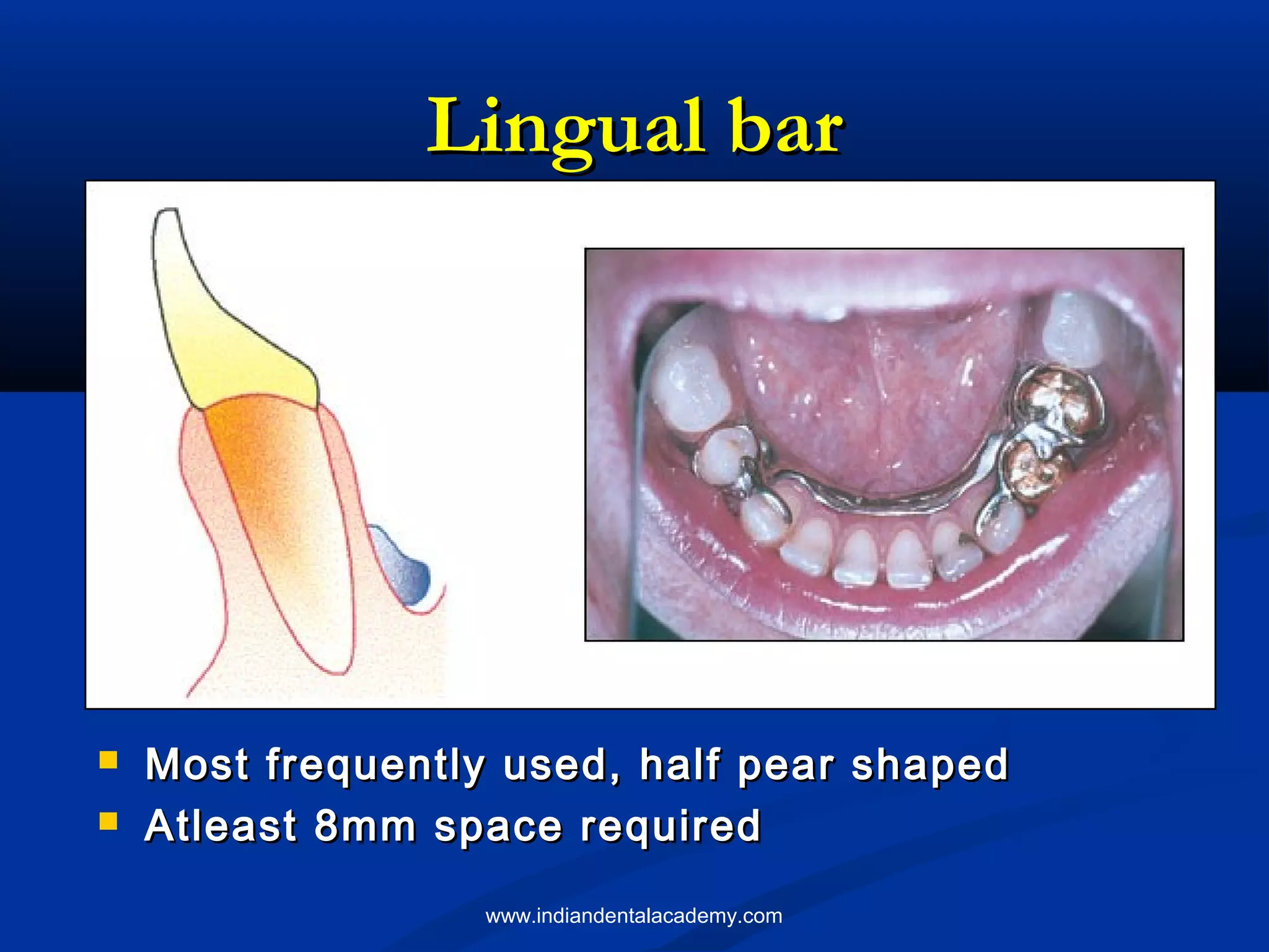 Role of component parts of cast partial dentures /dental courses | PPT