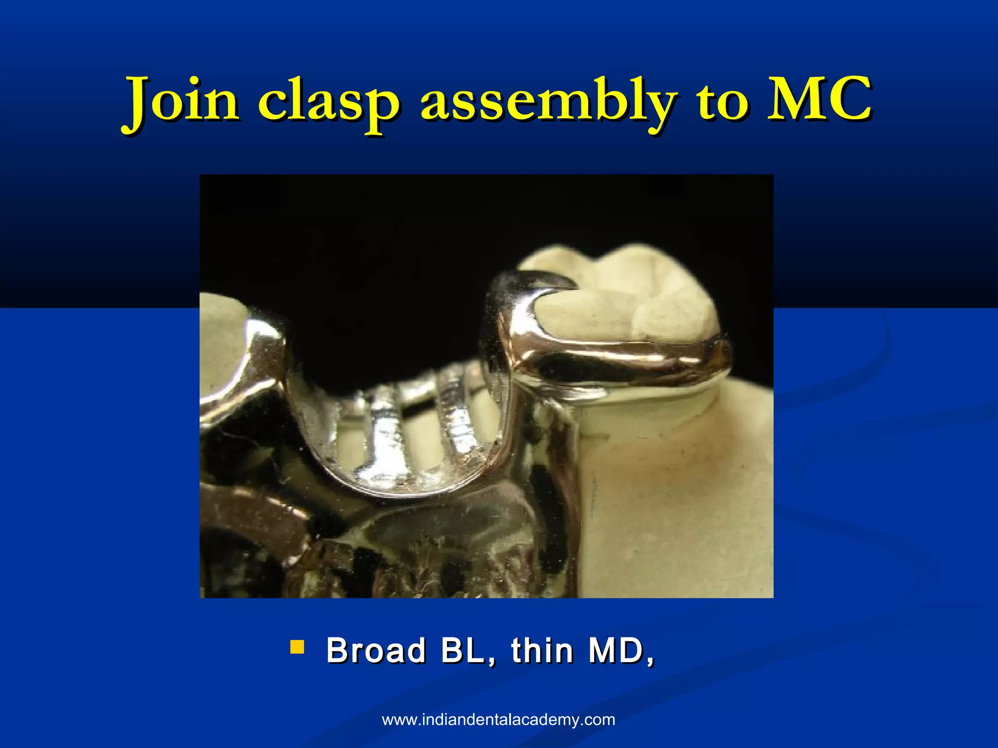 Role of component parts of cast partial dentures /dental courses | PPT