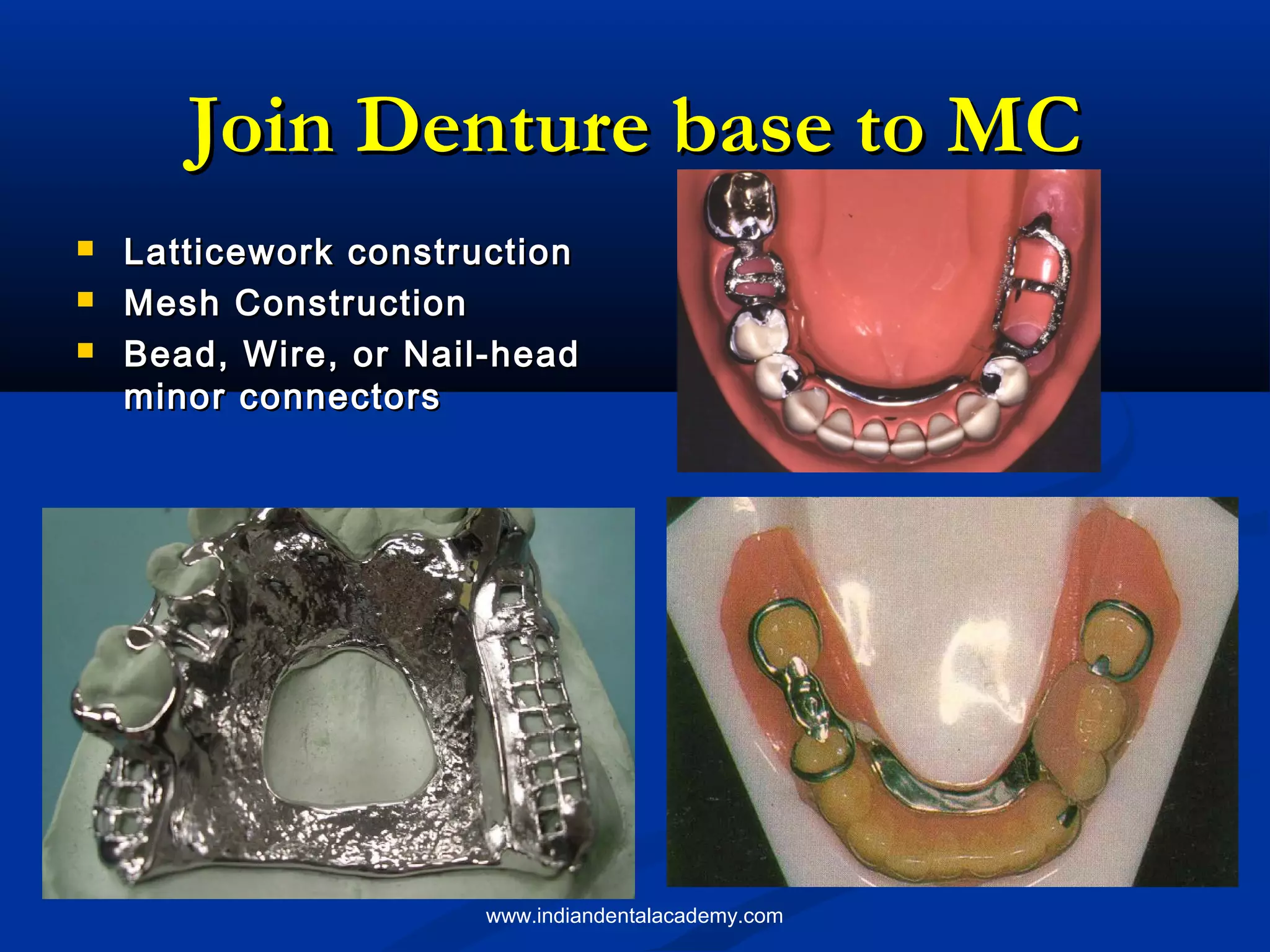 Role of component parts of cast partial dentures /dental courses | PPT
