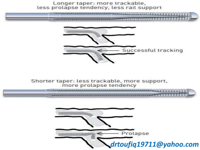 Components and classification of coronary guide wire dr md toufiqur ...