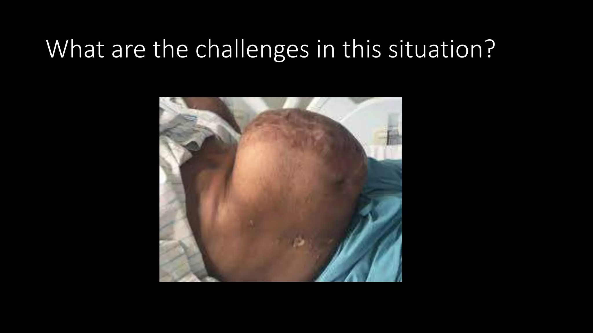 Component separation for ventral hernias prof. ahm shamsul alam | PPTX