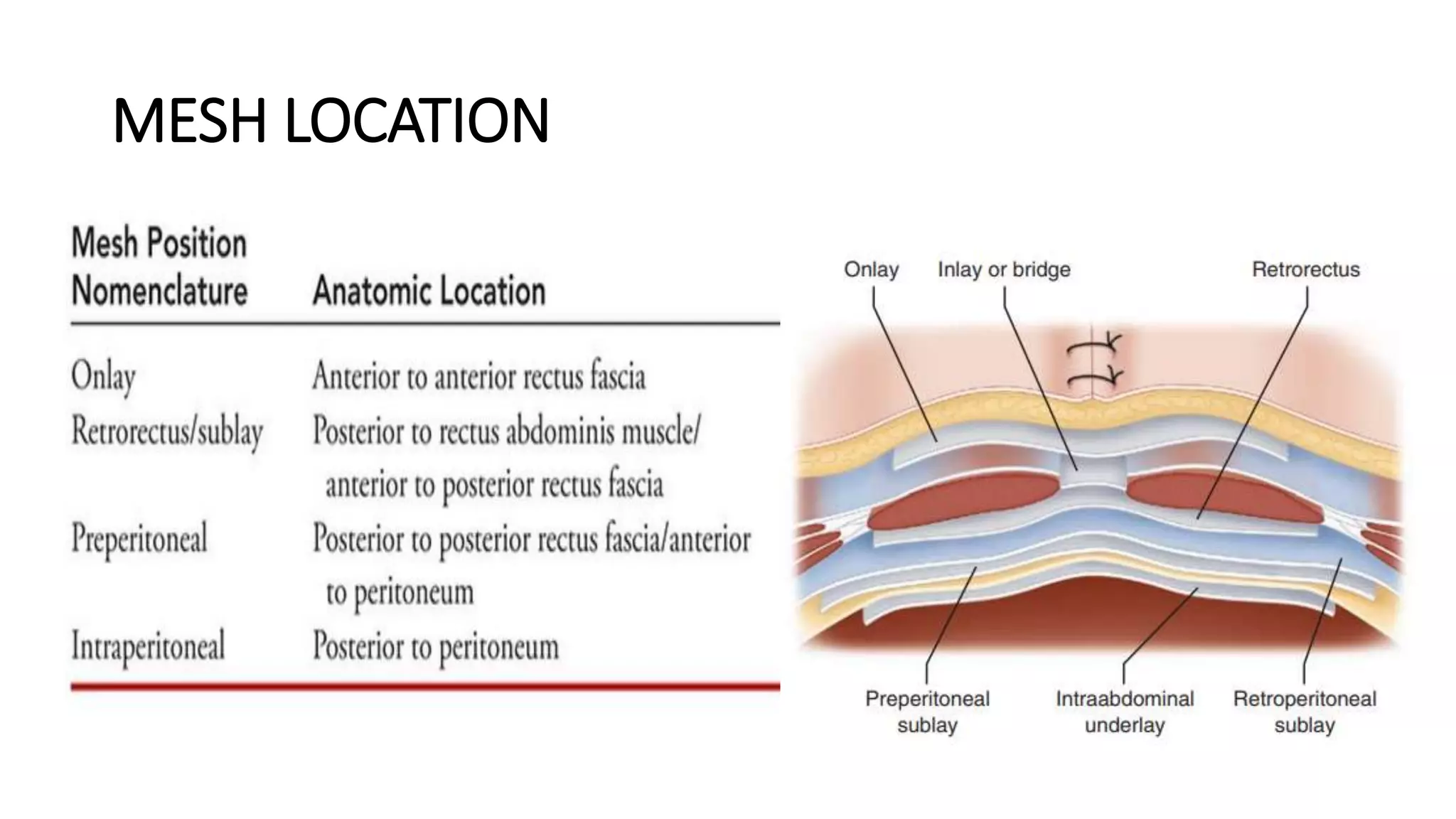 Component sepration techniques.pptx