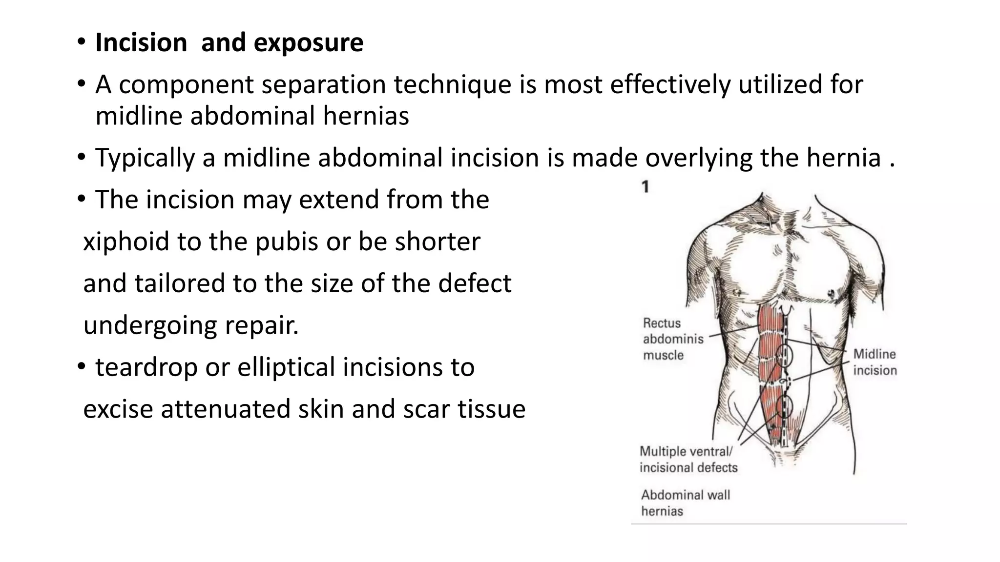 Component sepration techniques.pptx