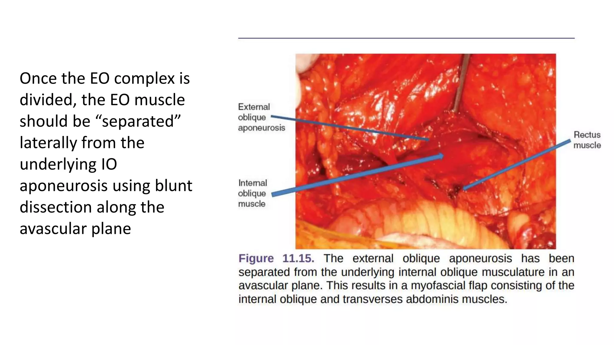 Component sepration techniques.pptx