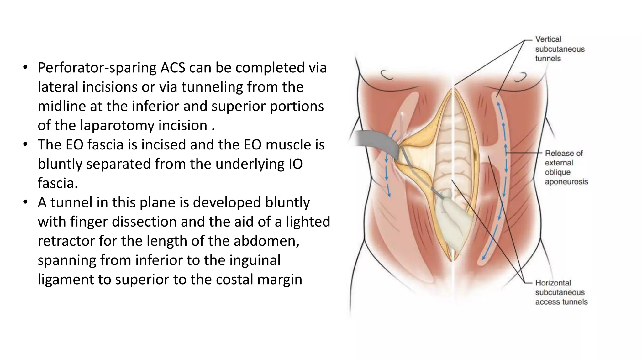 Component sepration techniques.pptx