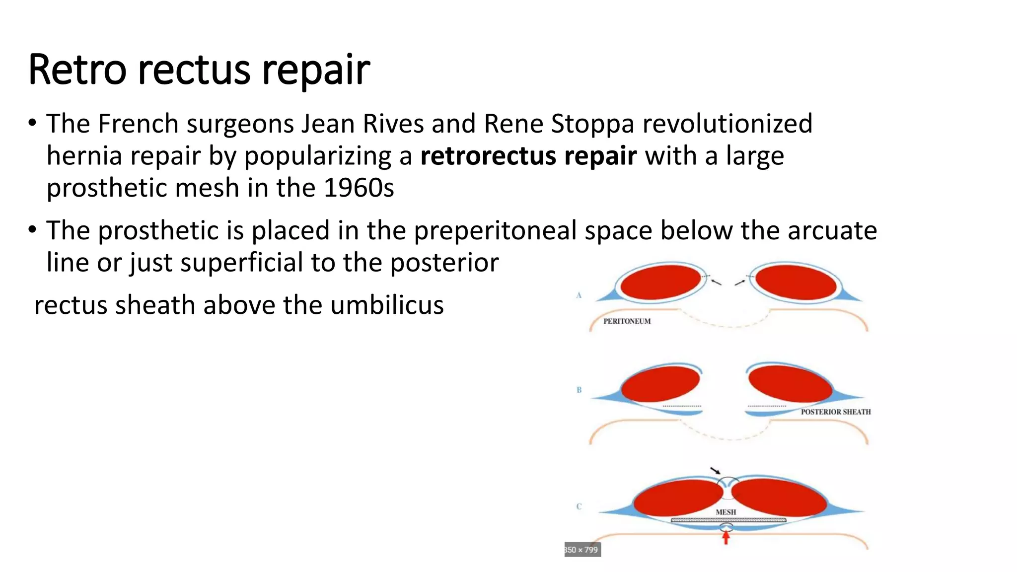 Component sepration techniques.pptx