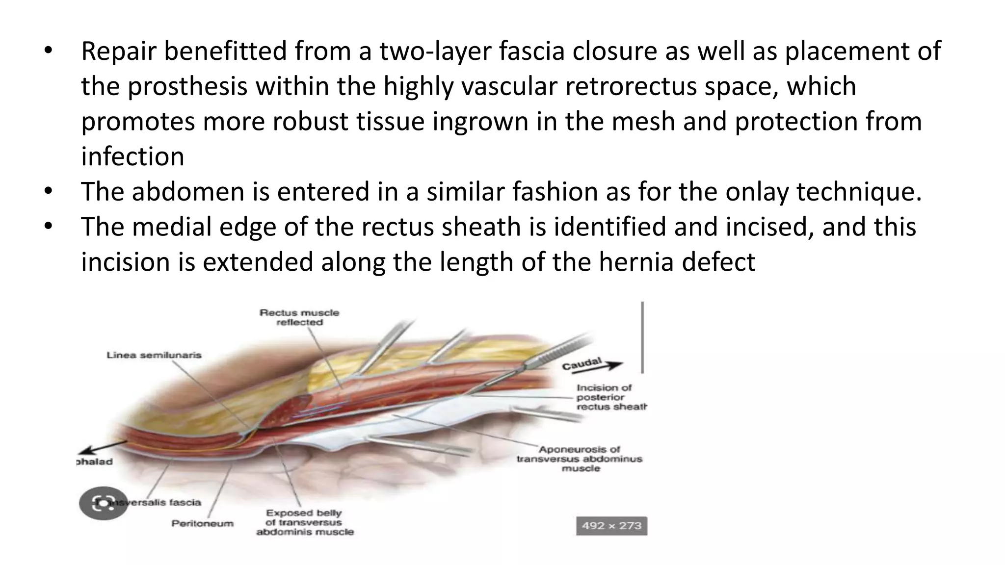 Component sepration techniques.pptx