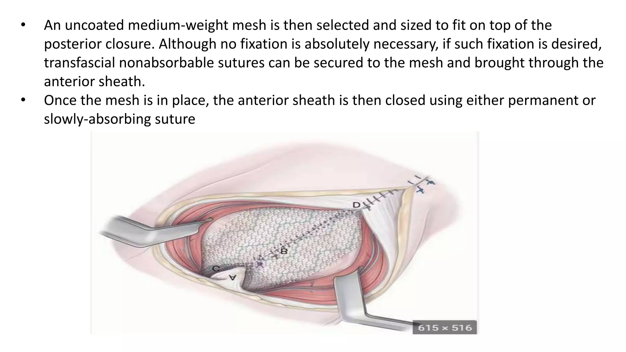 Component sepration techniques.pptx