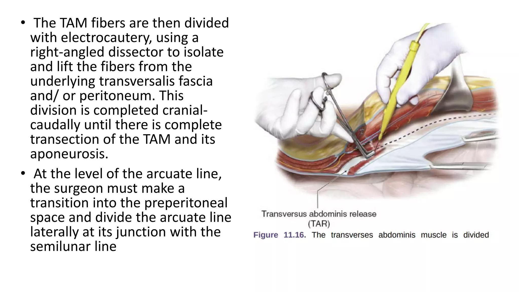 Component sepration techniques.pptx