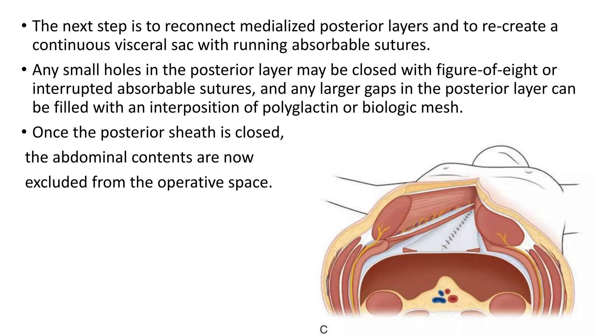Component sepration techniques.pptx