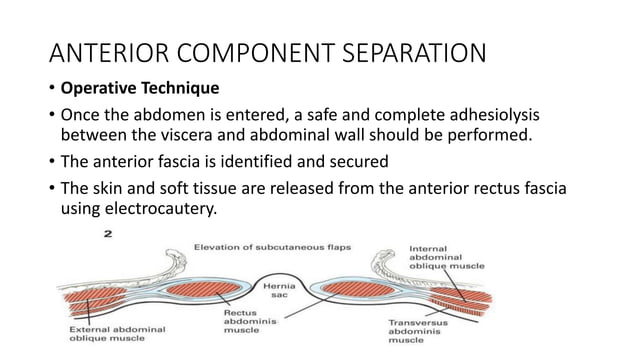 Component sepration techniques.pptx