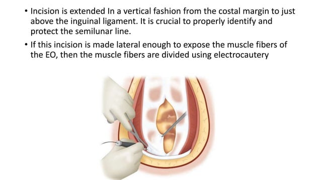 Component sepration techniques.pptx