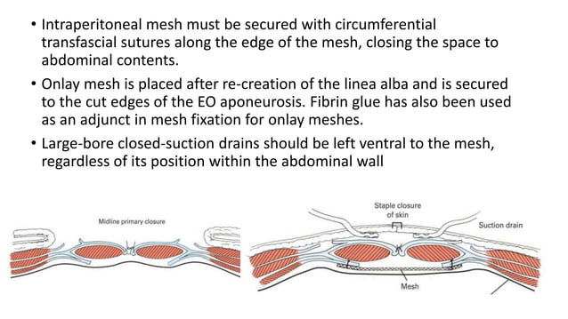 Component sepration techniques.pptx