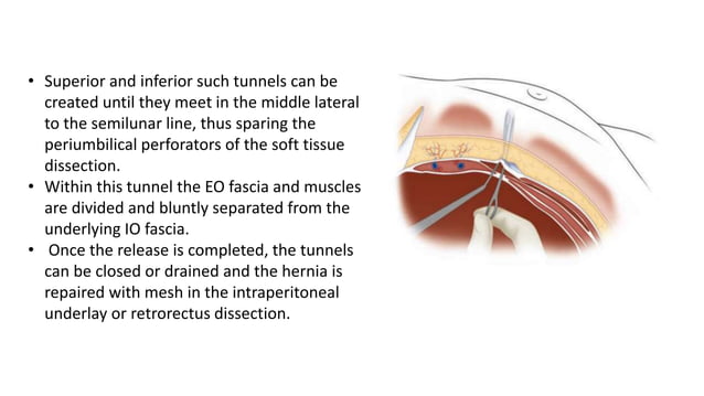 Component sepration techniques.pptx