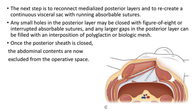 Component sepration techniques.pptx