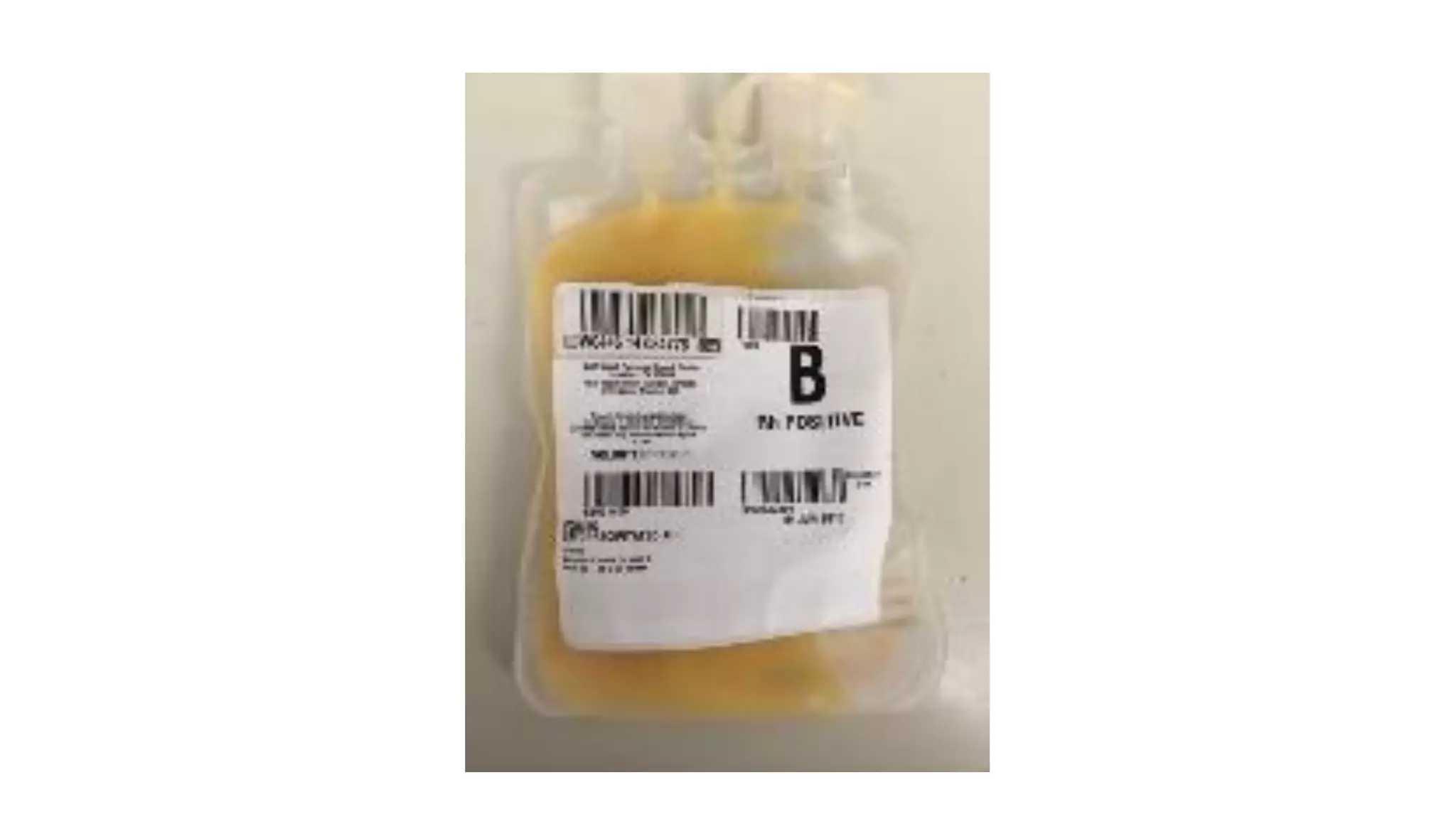 Components of blood (For Transfusion) | PDF