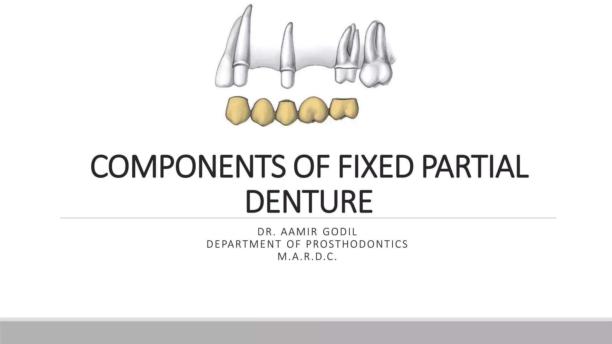 Components of Fixed Partial Denture | PDF