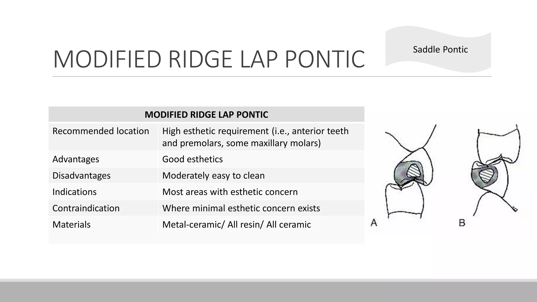 Components of Fixed Partial Denture | PDF