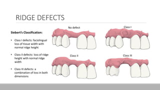 Components of Fixed Partial Denture | PPT