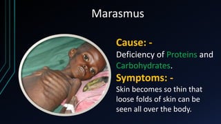 Components of food (Class 6) | PPTX