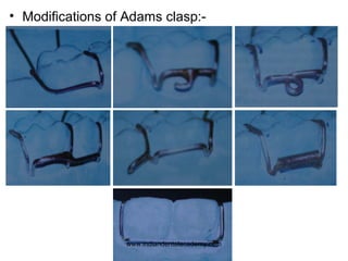 Components of removable appliances 2 /certified fixed orthodontic ...
