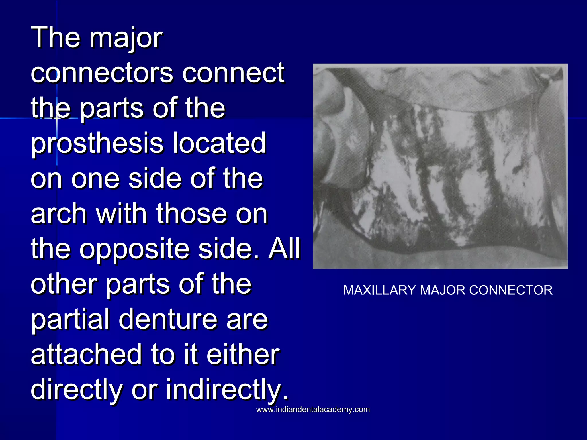 Components of removable partial denture prosthesis /certified fixed ...